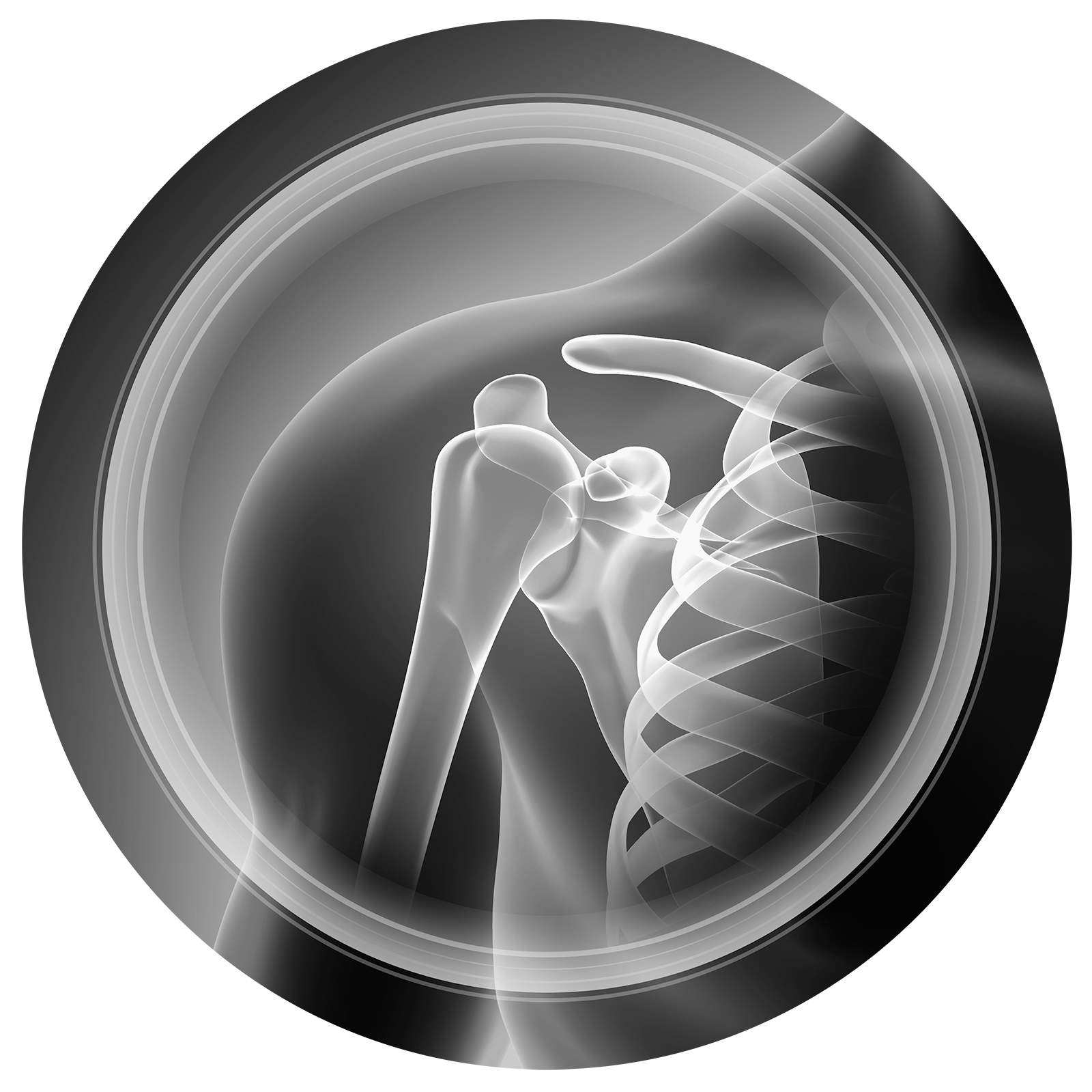 Shoulder Pain Treatment | Eric McCarty, MD | Boulder, Denver Colorado