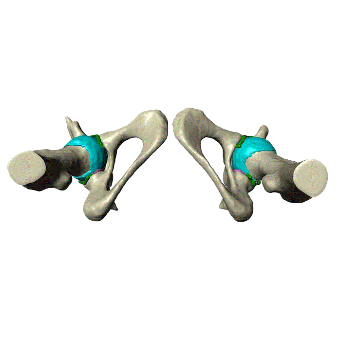 Hip Preservation Research at Children's Hospital Colorado | University ...